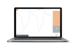 ReCIVA® Breath Sampler to Collect a Breath Sample