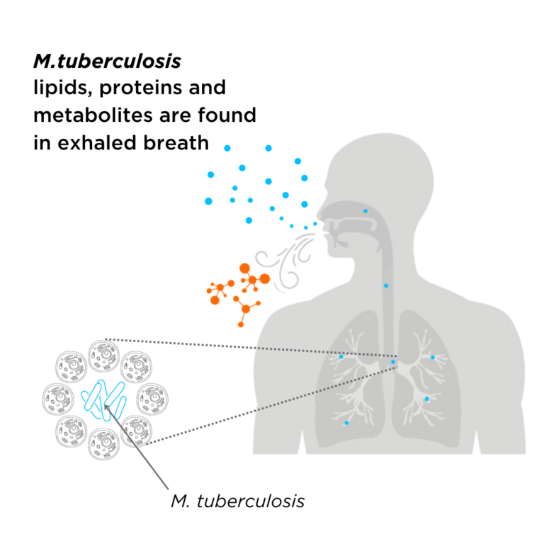 Explore Tuberculosis Through the Power of Breath Analysis.