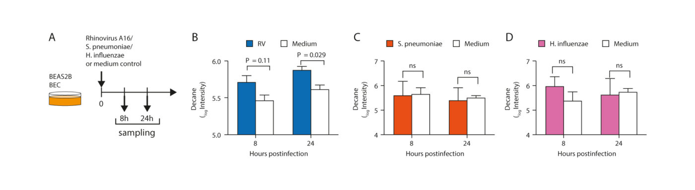 Breath Analysis for Diagnosing Viral Infections in COPD