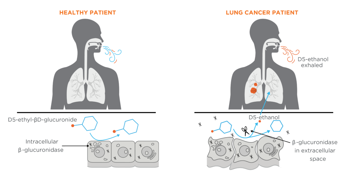 Lung Cancer - Challenges and Screening Advances