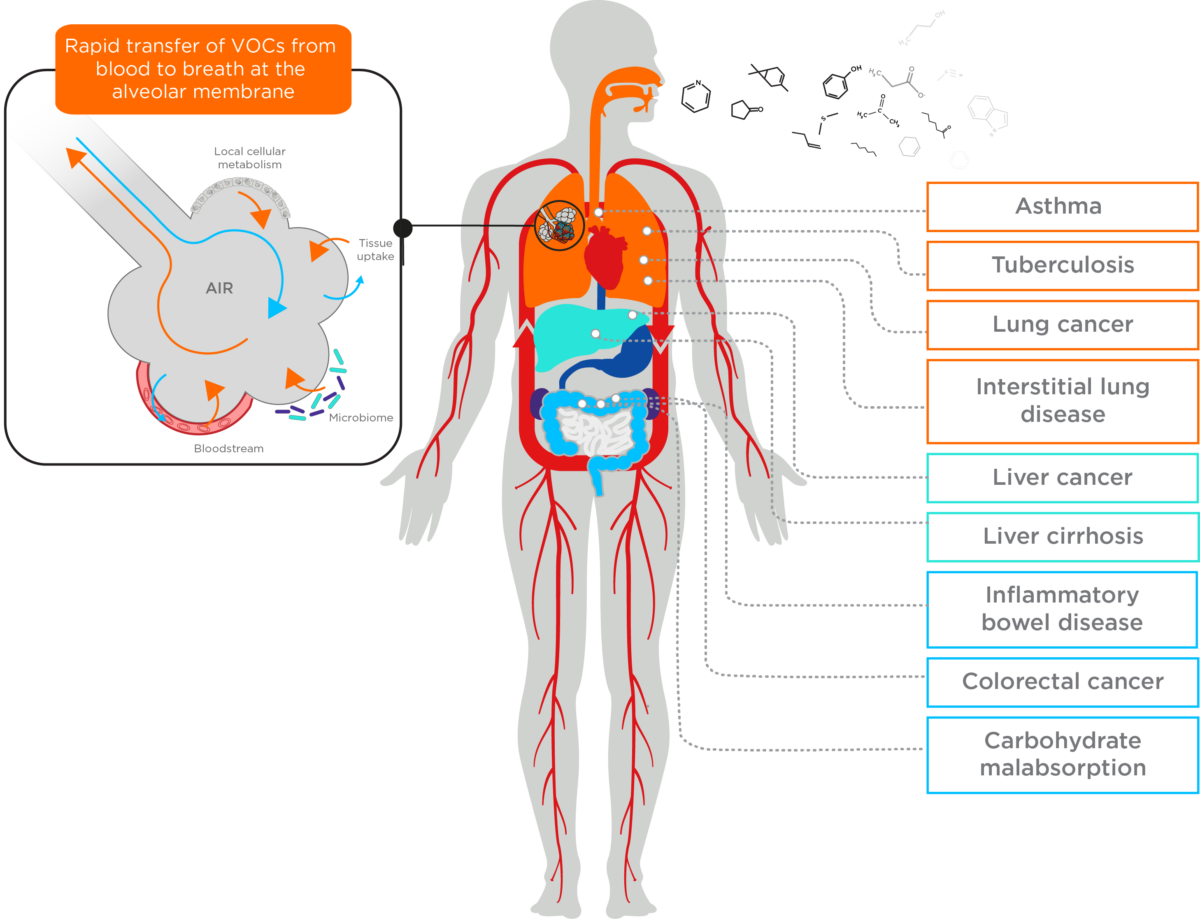 Insights from the Authors : Breath VOCs as a Biomarker Platform