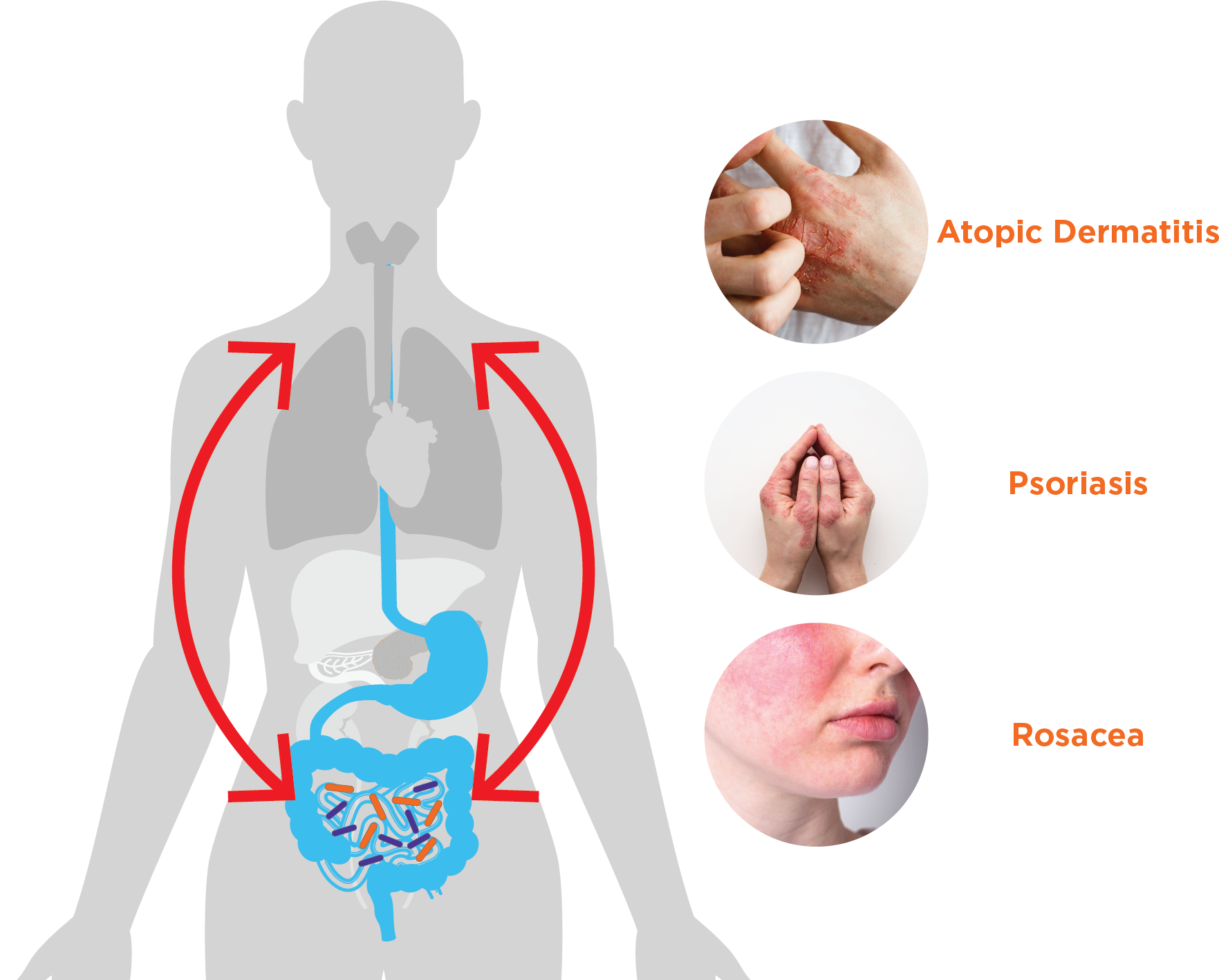 How the Gut Microbiome Influences Skin Health: Exploring the Gut-Skin Axis