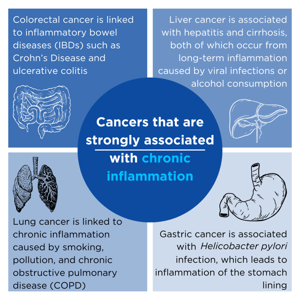The Link Between Inflammation and Cancer