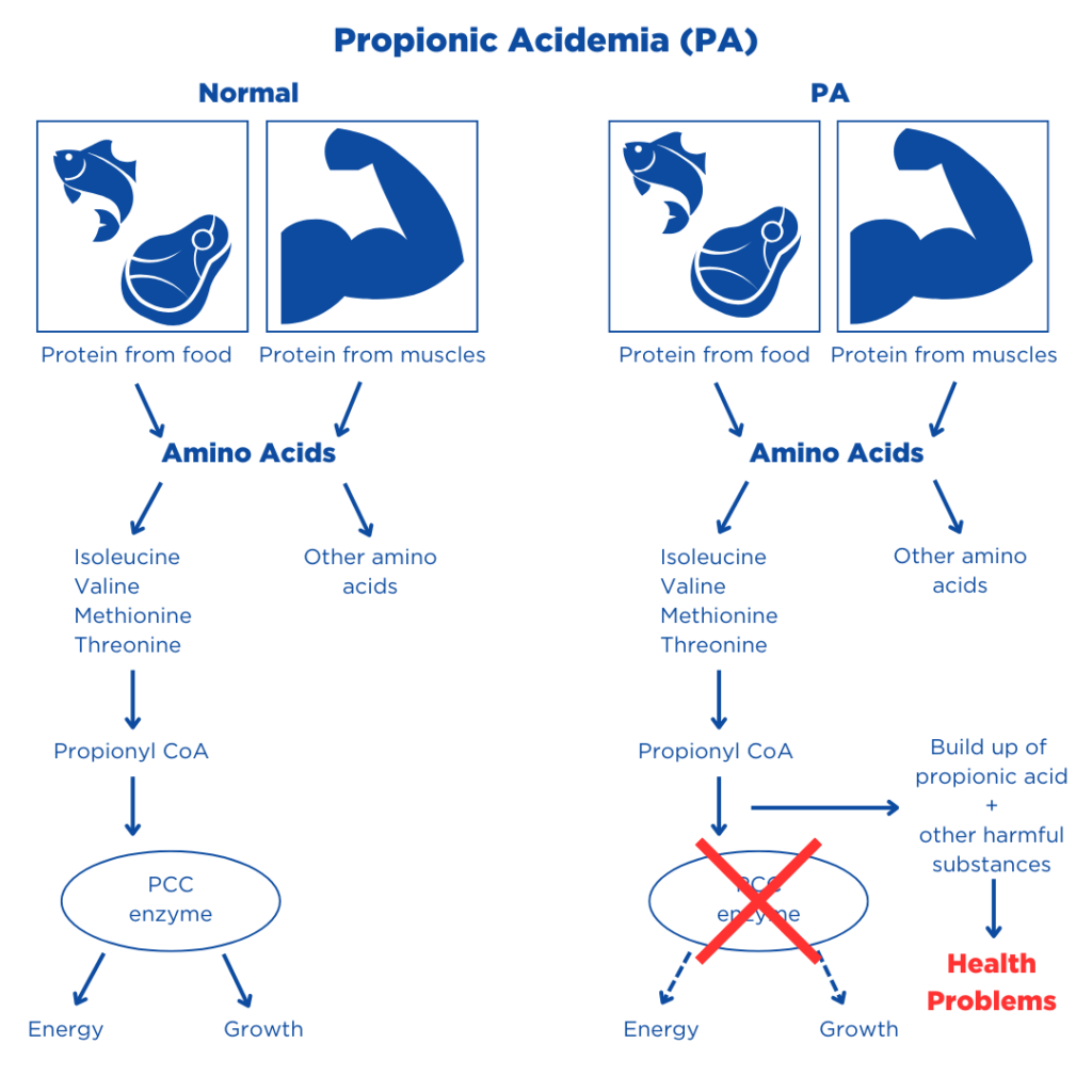 A Proof-of-Principle Study in Propionic Acidemia – Discover Breath ...